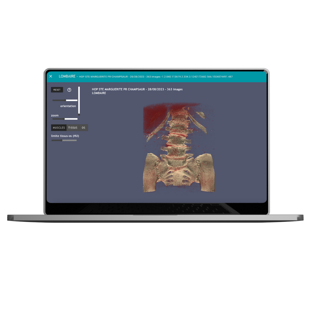 LiveAnatomy , le meilleur logiciel pour ostéopathes